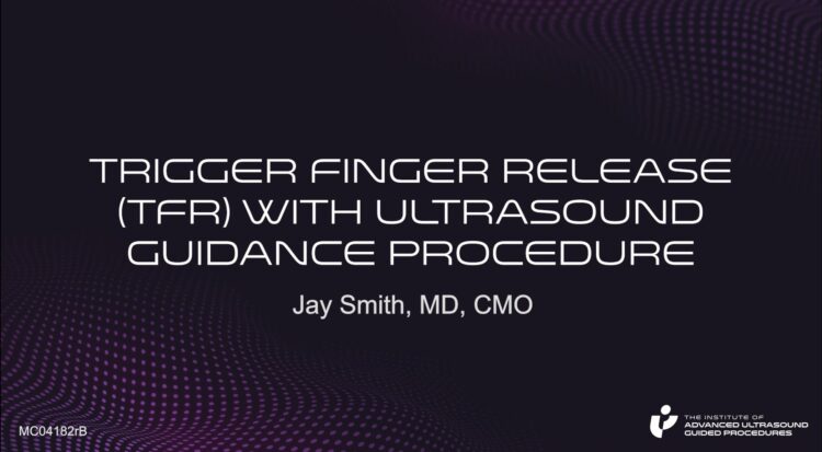 Trigger Finger Release (TFR) with Ultrasound Guidance - Sonex Health
